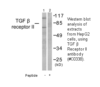 TGF β Receptor II Antibody | AAT Bioquest