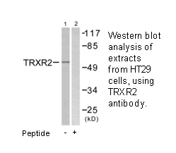 TRXR2 Antibody | AAT Bioquest