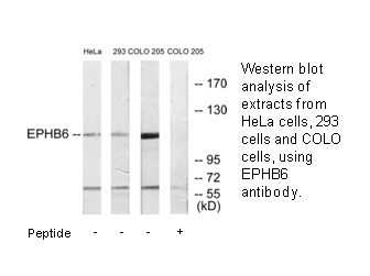 EPHB6 Antibody | AAT Bioquest