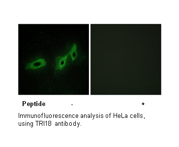 TRI18 Antibody | AAT Bioquest