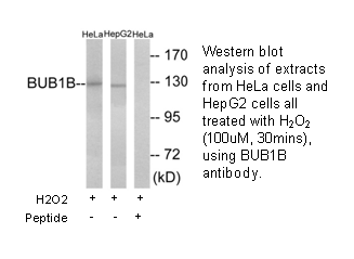 BUB1B Antibody | AAT Bioquest