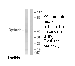 Dyskerin Antibody | AAT Bioquest