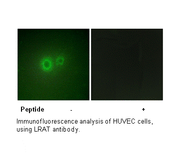 LRAT Antibody | AAT Bioquest