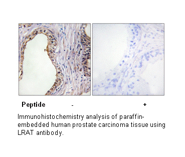 LRAT Antibody | AAT Bioquest