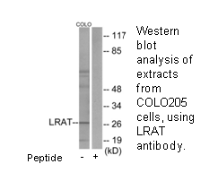 LRAT Antibody | AAT Bioquest