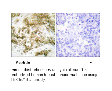 TBX15/18 Antibody | AAT Bioquest