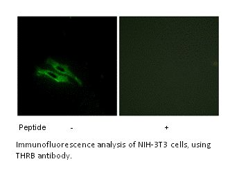 THRB Antibody | AAT Bioquest