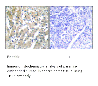 THRB Antibody | AAT Bioquest