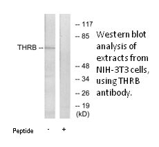 THRB Antibody | AAT Bioquest