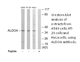 ALDOA Antibody | AAT Bioquest