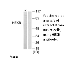 HEXB Antibody | AAT Bioquest