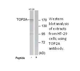 TOP2A Antibody | AAT Bioquest