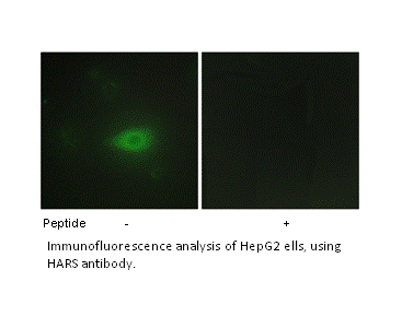 HARS Antibody | AAT Bioquest