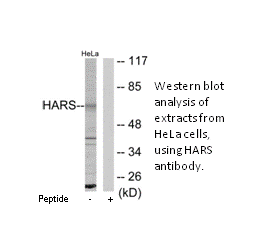 HARS Antibody | AAT Bioquest