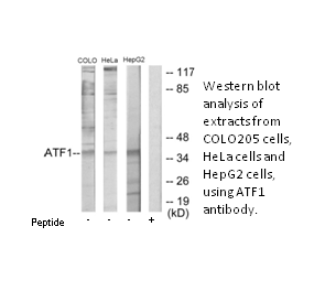 ATF1 Antibody | AAT Bioquest
