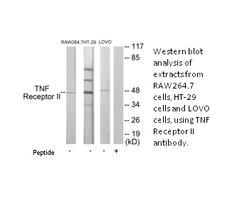 TNF Receptor II Antibody | AAT Bioquest