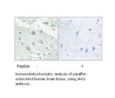 JAK1 Antibody | AAT Bioquest