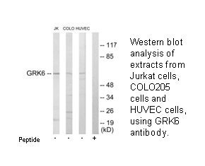 GRK6 Antibody | AAT Bioquest