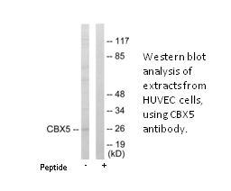 CBX5 Antibody | AAT Bioquest