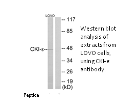 CKI-ε Antibody | AAT Bioquest