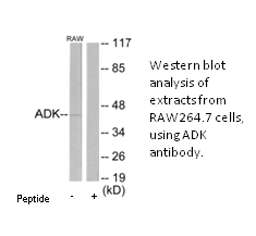 ADK Antibody | AAT Bioquest