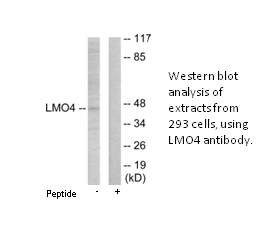 LMO4 Antibody | AAT Bioquest