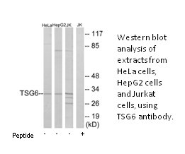 TSG6 Antibody | AAT Bioquest
