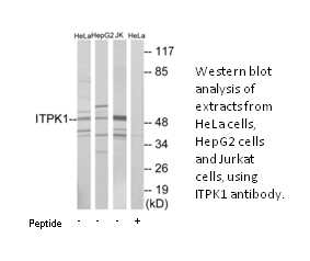 ITPK1 Antibody | AAT Bioquest