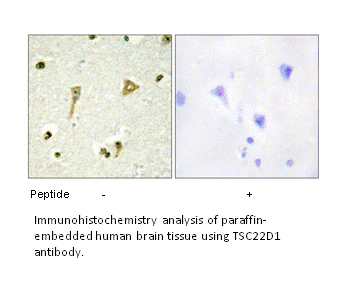TSC22D1 Antibody | AAT Bioquest