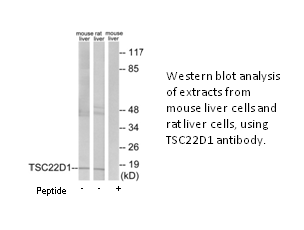 TSC22D1 Antibody | AAT Bioquest