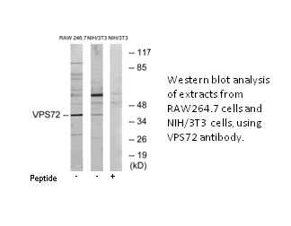 VPS72 Antibody | AAT Bioquest