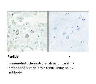 DOK7 Antibody | AAT Bioquest