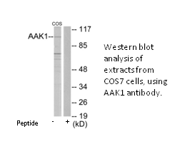 AAK1 Antibody | AAT Bioquest