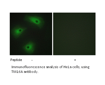 TM16A Antibody | AAT Bioquest