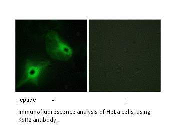 KSR2 Antibody | AAT Bioquest