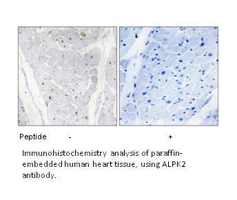 ALPK2 Antibody | AAT Bioquest