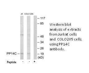 PP14C Antibody | AAT Bioquest