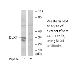 DLX4 Antibody | AAT Bioquest