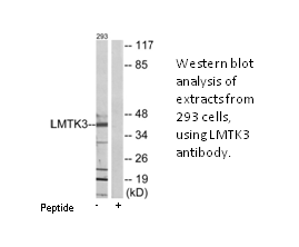 LMTK3 Antibody | AAT Bioquest