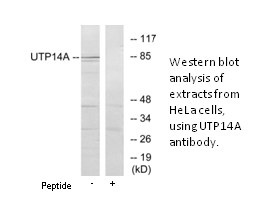 UTP14A Antibody | AAT Bioquest
