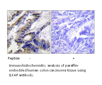 ILKAP Antibody | AAT Bioquest