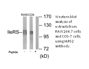 IARS2 Antibody | AAT Bioquest