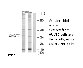 CNOT7 Antibody | AAT Bioquest