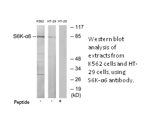 S6K-α6 Antibody | AAT Bioquest