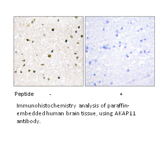 AKAP11 Antibody | AAT Bioquest