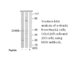 CHKB Antibody | AAT Bioquest