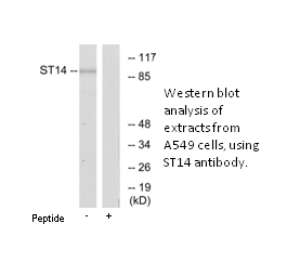 ST14 Antibody | AAT Bioquest