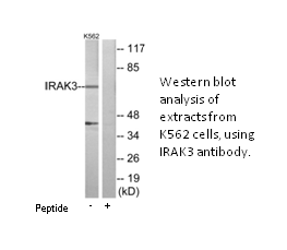 IRAK3 Antibody | AAT Bioquest