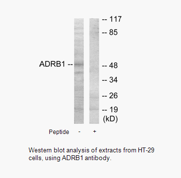ADRB1 Antibody | AAT Bioquest