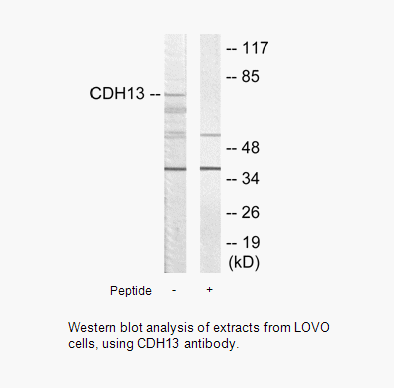 CDH13 Antibody | AAT Bioquest